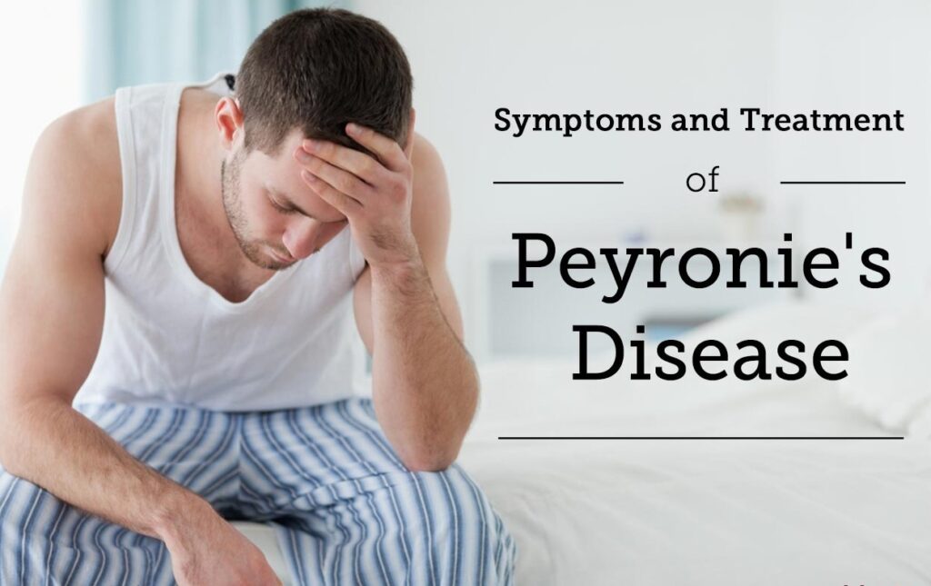 Peyronies Systemic Enzyme Therapy for Peyronies Disease